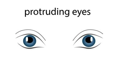 8 Types différents de Formes d'yeux | TJMBB